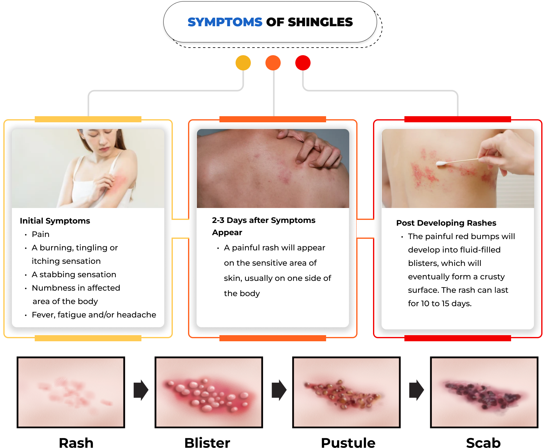 Beginning Stages Of Shingles